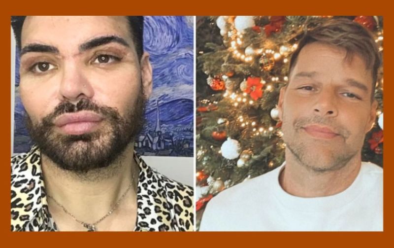 HOMEM FAZ MAIS DE 30 CIRURGIAS PLÁSTICAS PARA SE PARECER COM RICKY ...